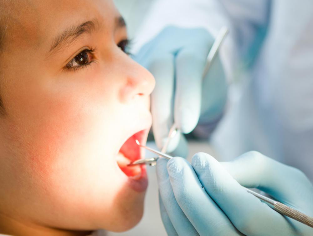 Does Medicaid Cover Dental with Pictures Does Medicaid Cover Dental with Pictures