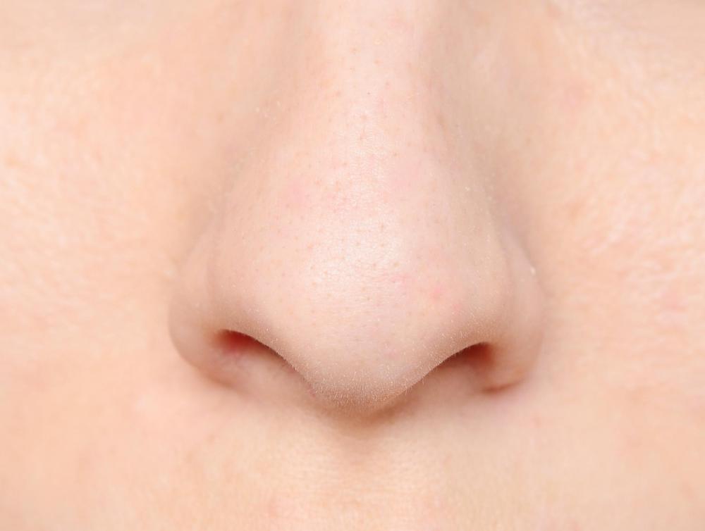 What Is White Mucus with Pictures 