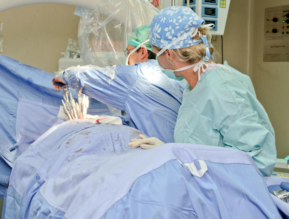 What Is An Adnexal Mass with Pictures What Is An Adnexal Mass with Pictures